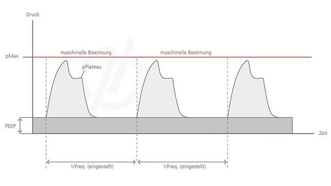 Volumenkontrollierte Beatmung für optimale Atemtherapie